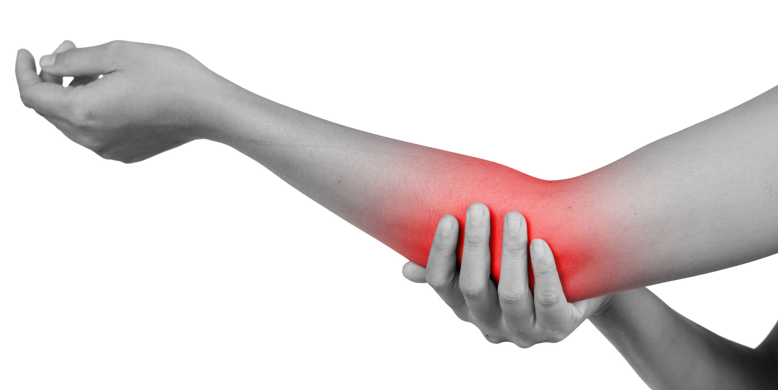Cubital Tunnel Syndrome - Eagle Rock Physical Therapy